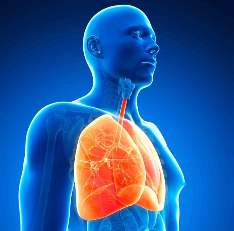 Aspergilloma (Fungus Ball in Lungs): Causes, Symptoms