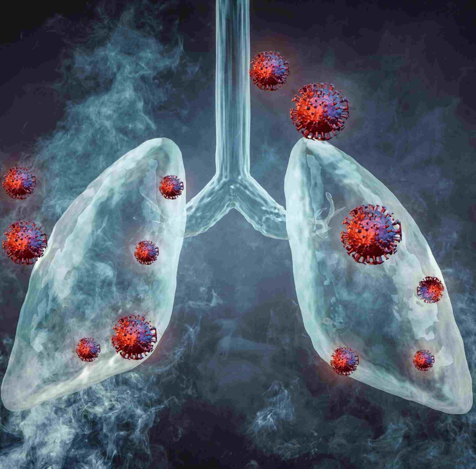 Aspergilloma (Fungus Ball in Lungs): Causes, Symptoms